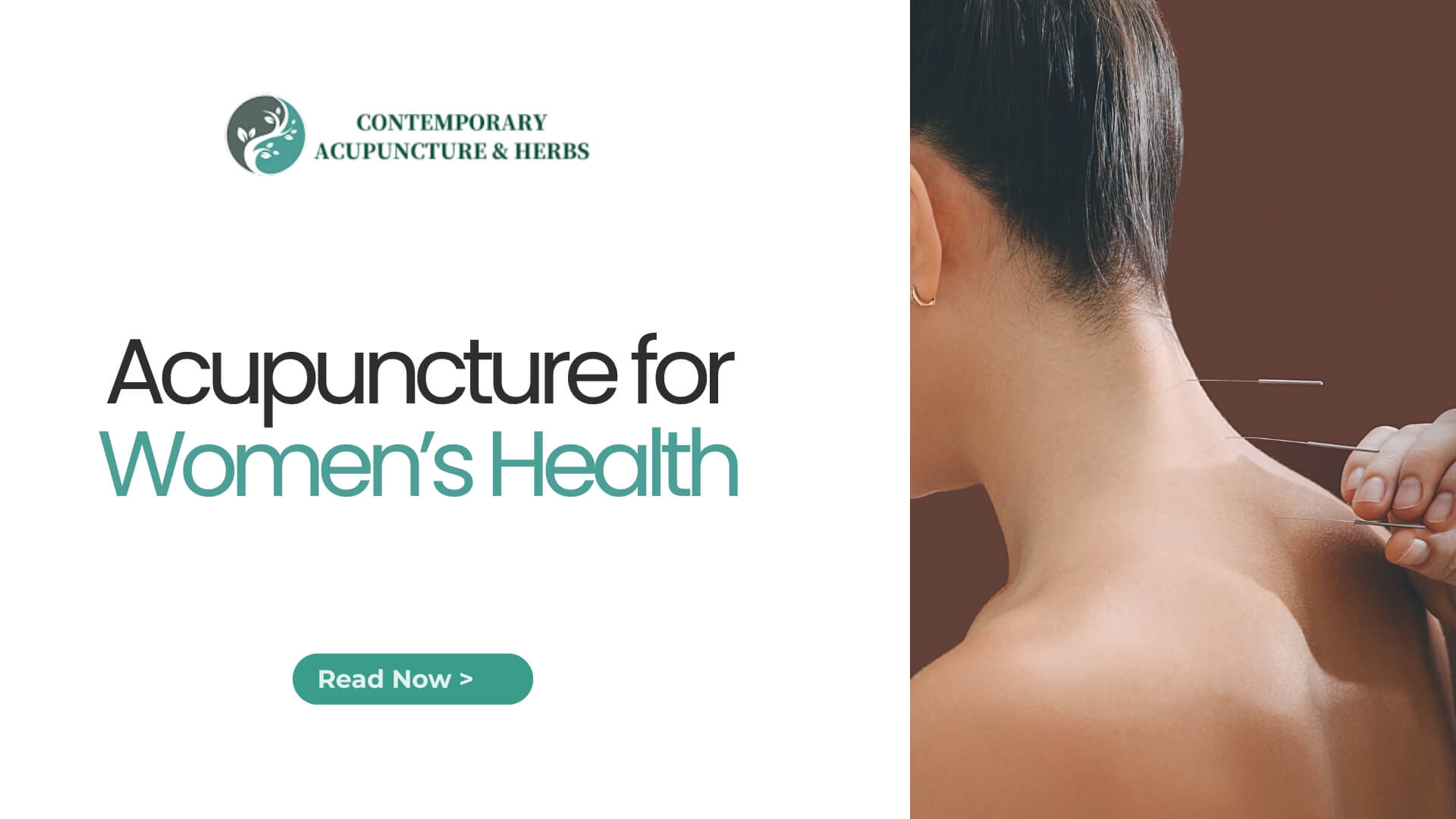 Acupuncture Benefits for Women | Hormonal & Fertility Support